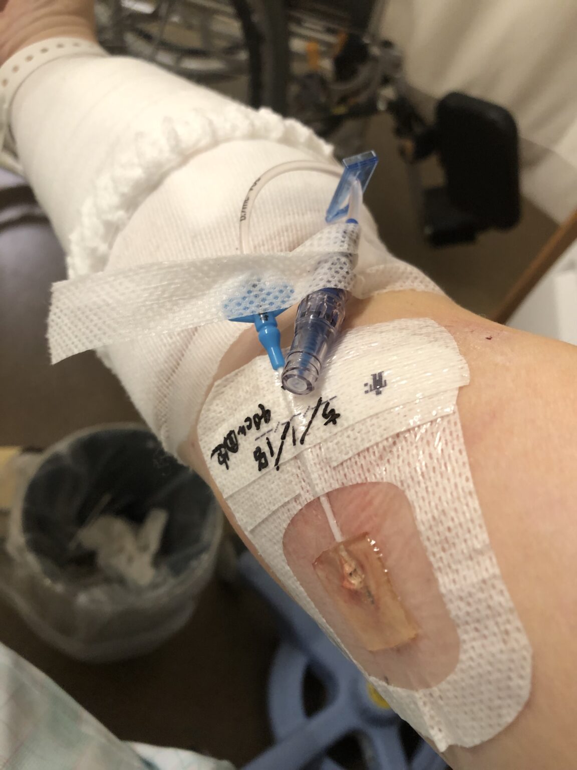 入院22日目:PICCピックをつけた | 糖尿病で膝下切断かもしれない42歳の闘病日記